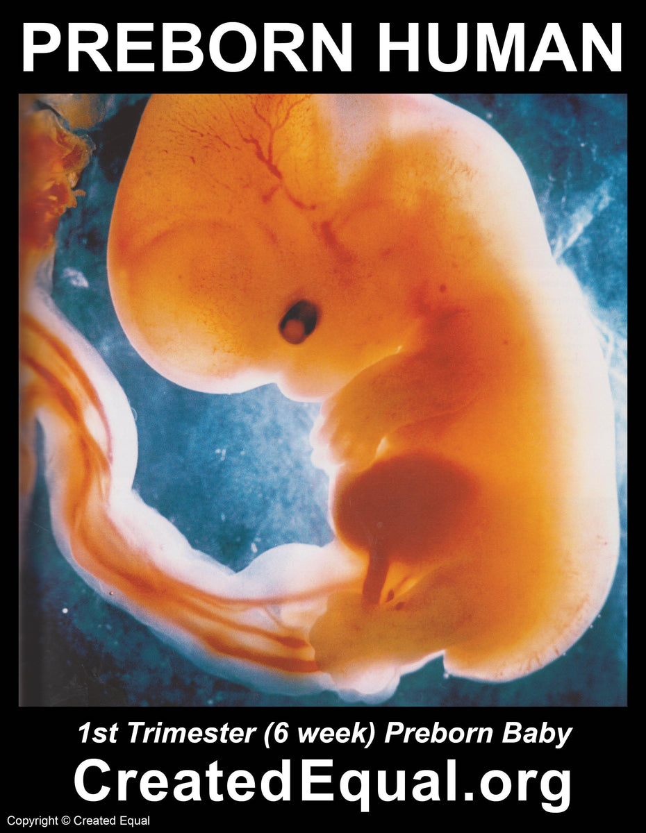 Preborn Baby Signs – Created Equal Store