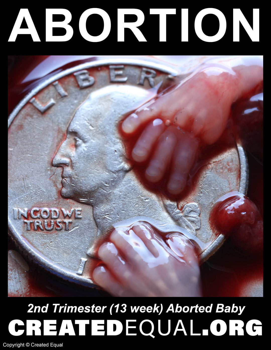 Abortion Signs | Created Equal Store – Page 2