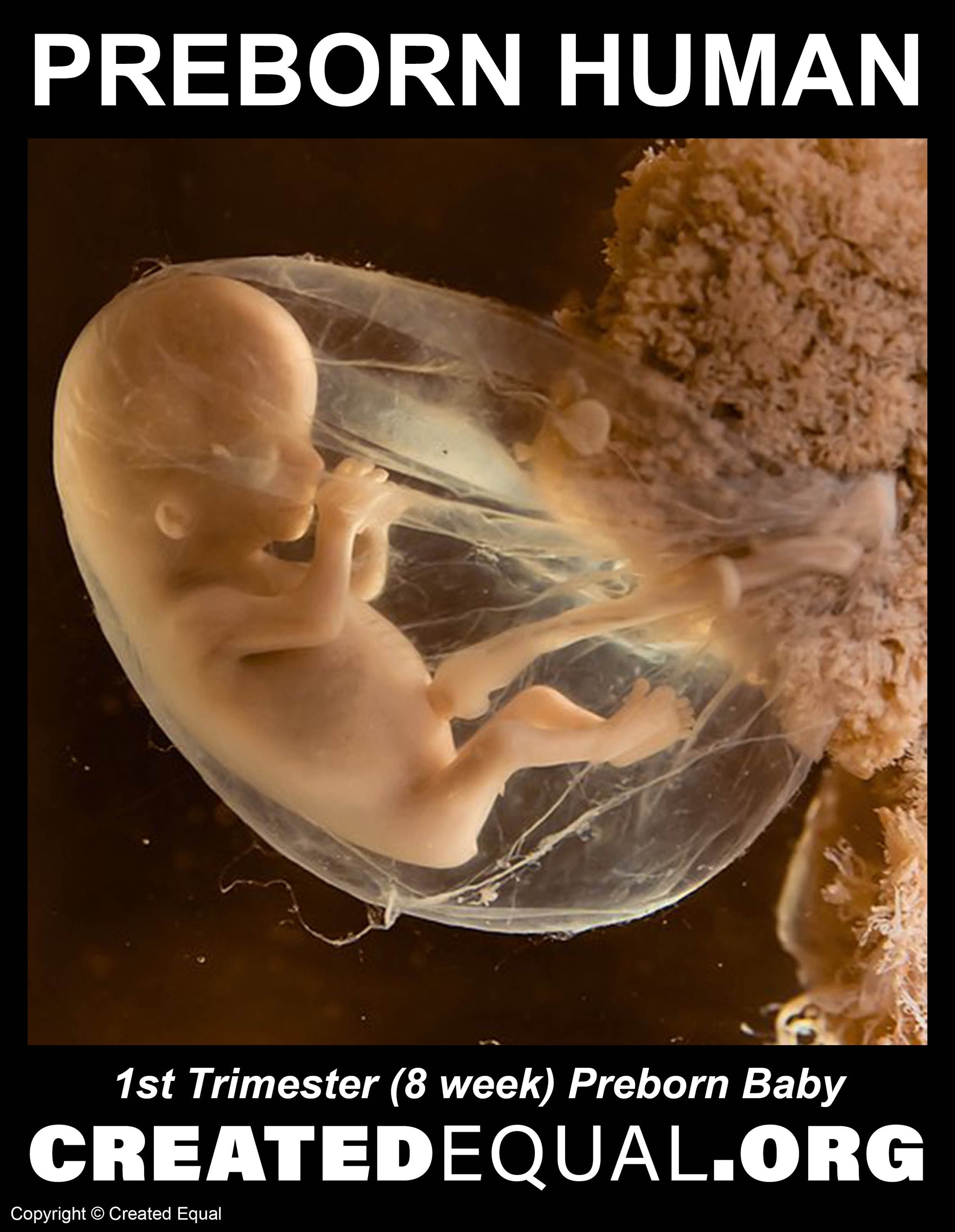 Preborn Baby Signs – Created Equal Store